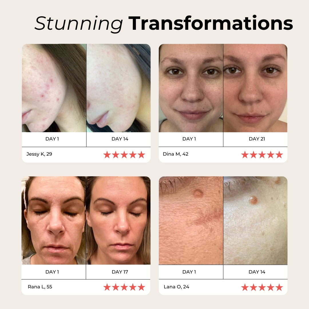 Lume. Anti-Aging Bundle | #1 Solution for Glowing Skin – lume.